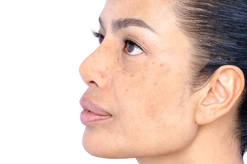 Expert Tips and Product Recommendations to Help you Target ...