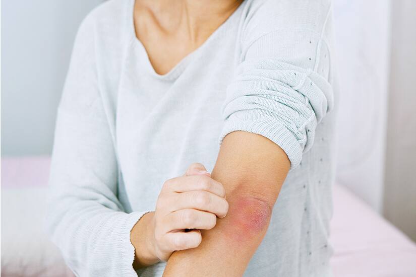 How psychodermatology can help combat both your skin issues and mental ...