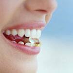 Easy smile solutions for sparkling teeth | Canadian Living