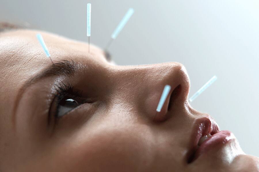 What you need to know about facial acupuncture | Canadian Living