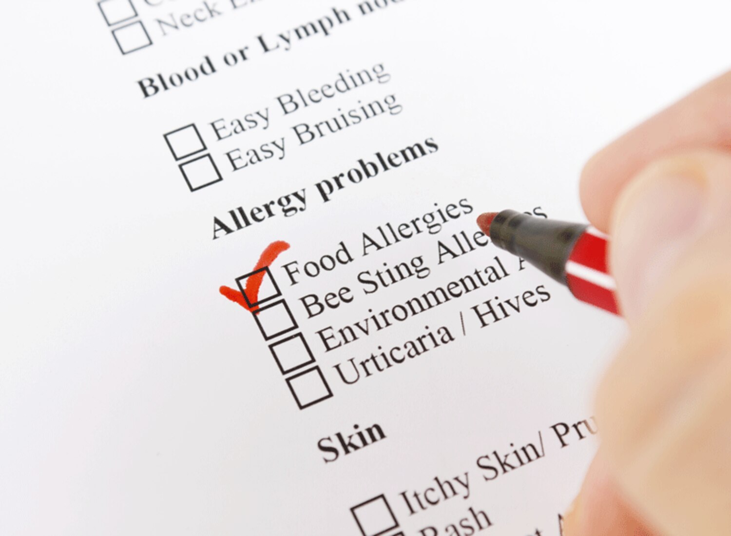 Six steps to know in a food allergy emergency | Canadian Living