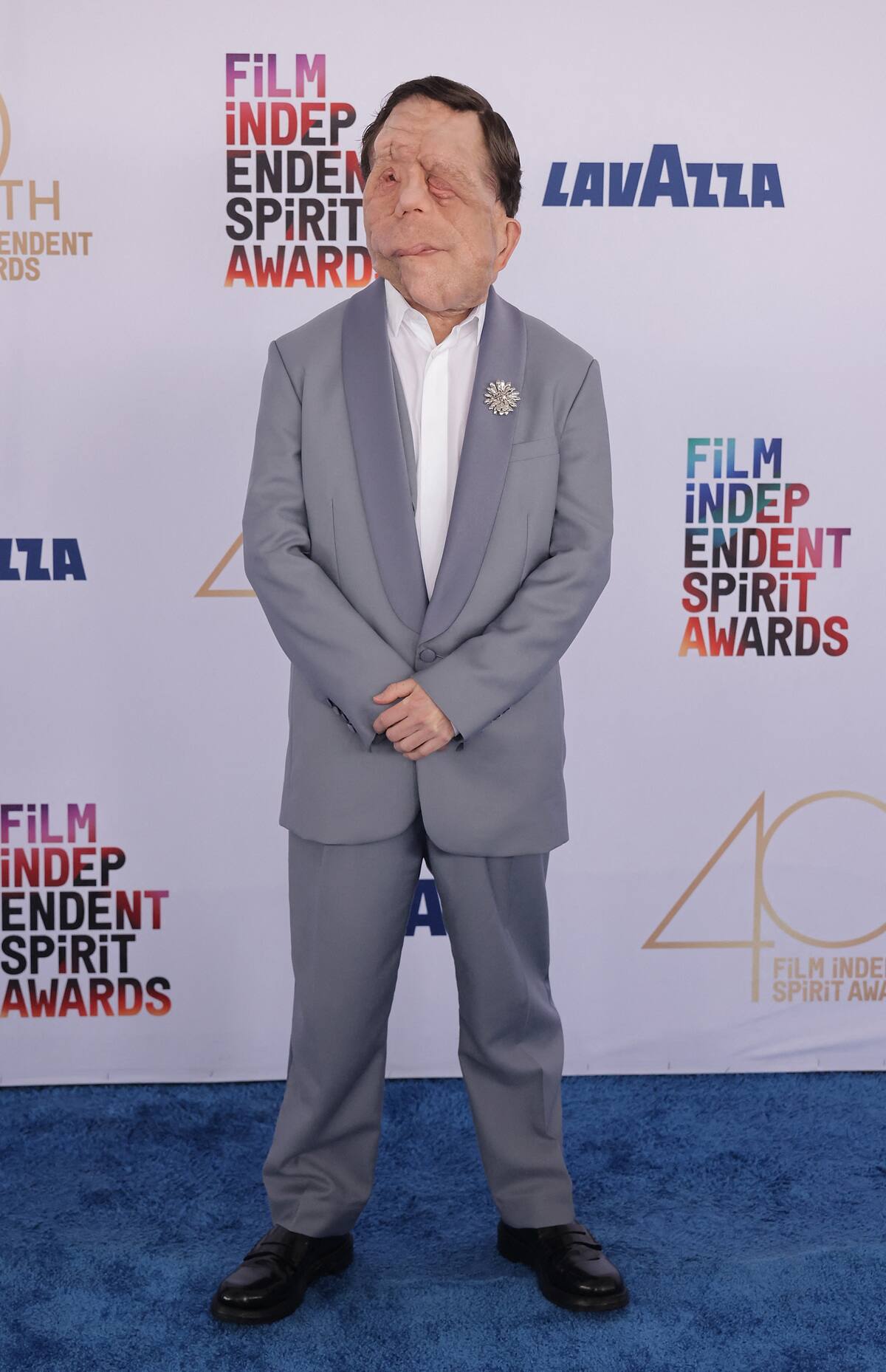 L’acteur Adam Pearson sera dans la prochaine adaptation du film «L’homme éléphant» | JDM