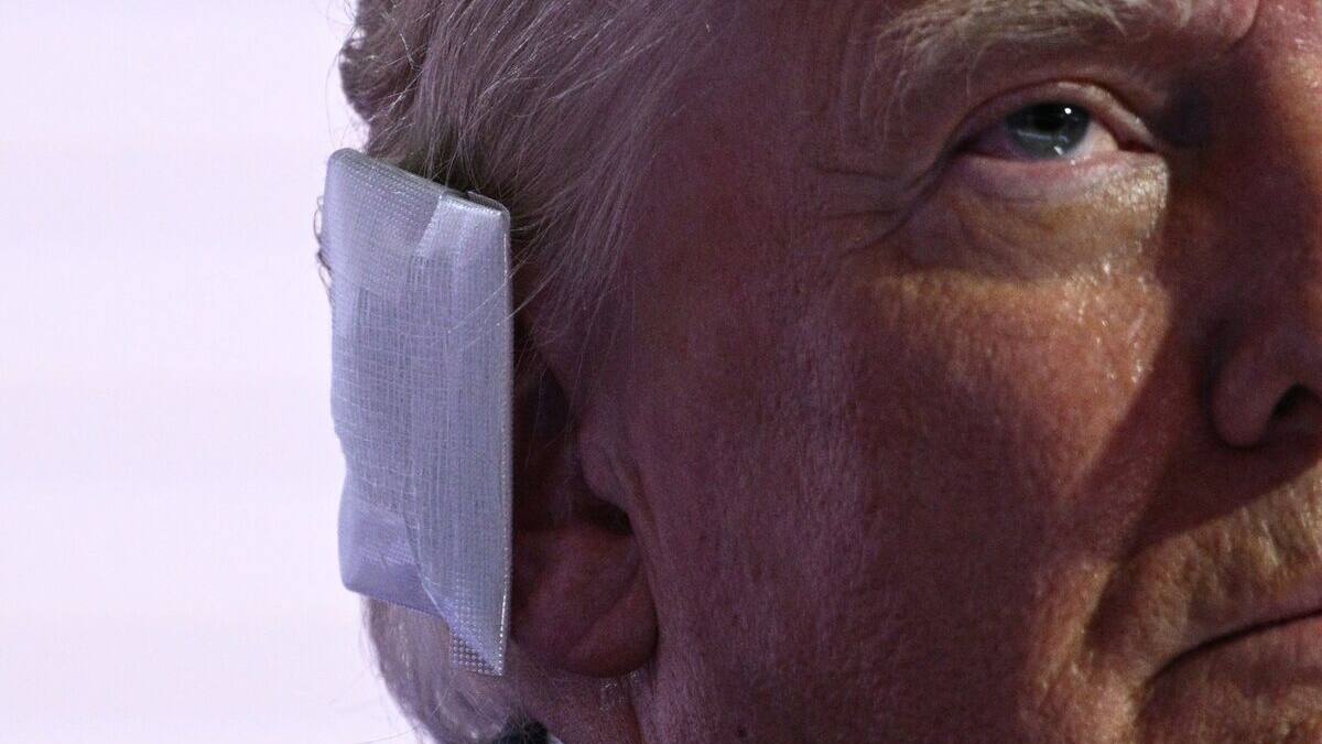 Après Des Critiques De Trump Le Fbi Confirme Quil A été Blessé Par