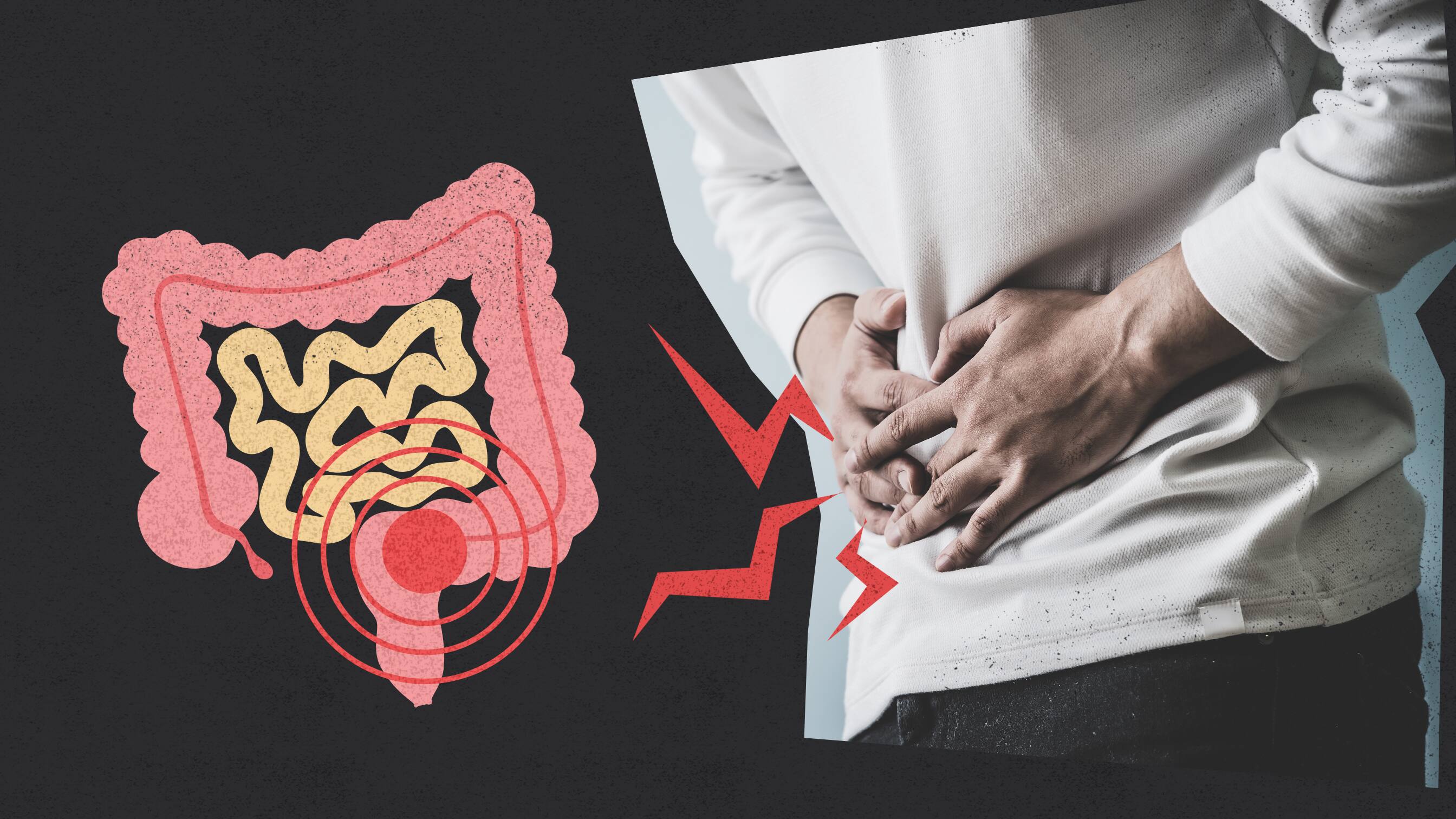 Les cas de cancer colorectal explosent chez les jeunes: voici ce qu’il ...