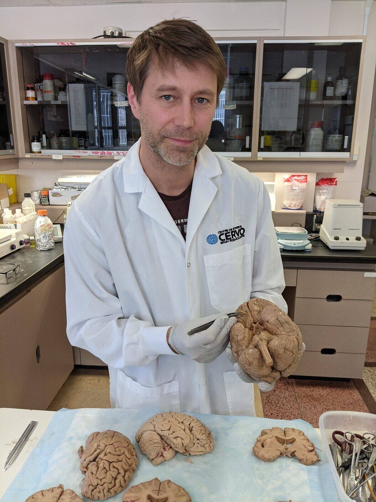 This brain bank has more than 600 specimens that advance research – Archyde