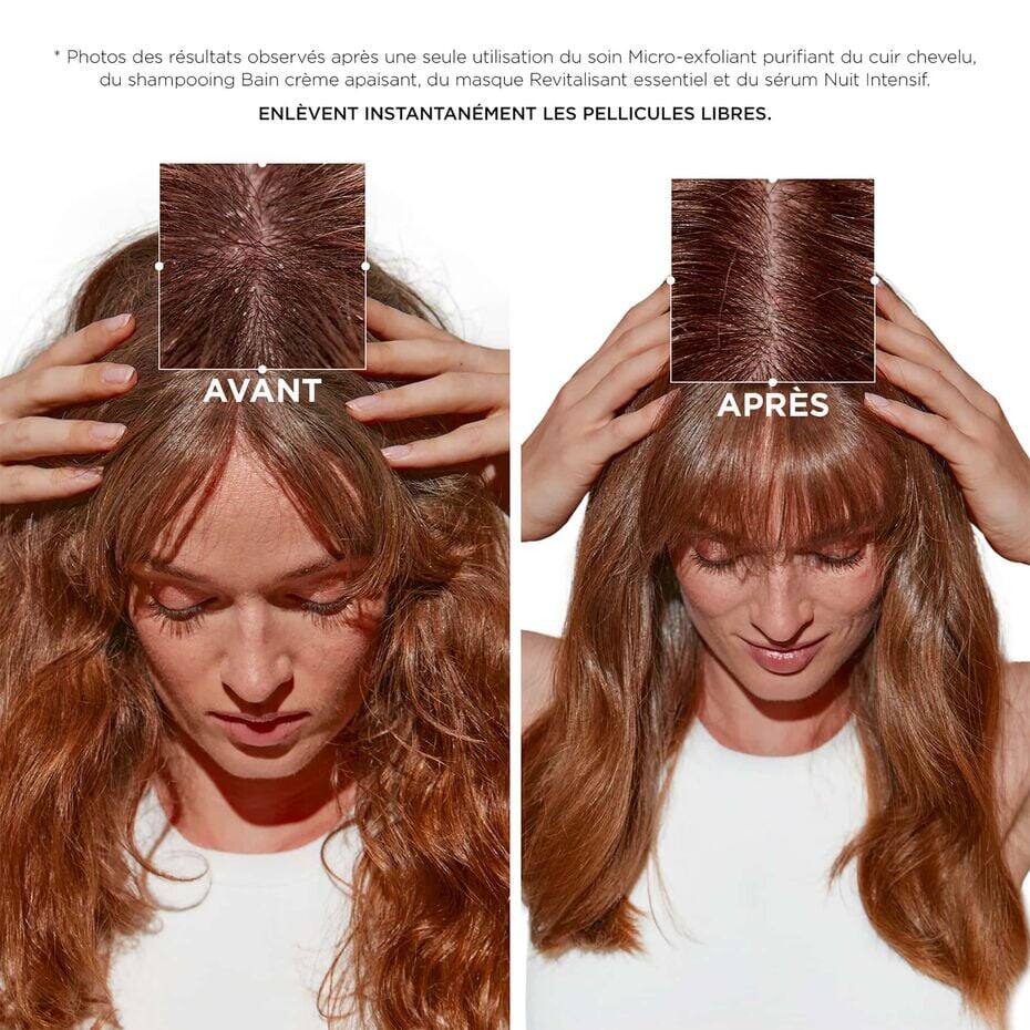 Ces soins vous aideront à vous débarrasser pour de bon des pellicules ...