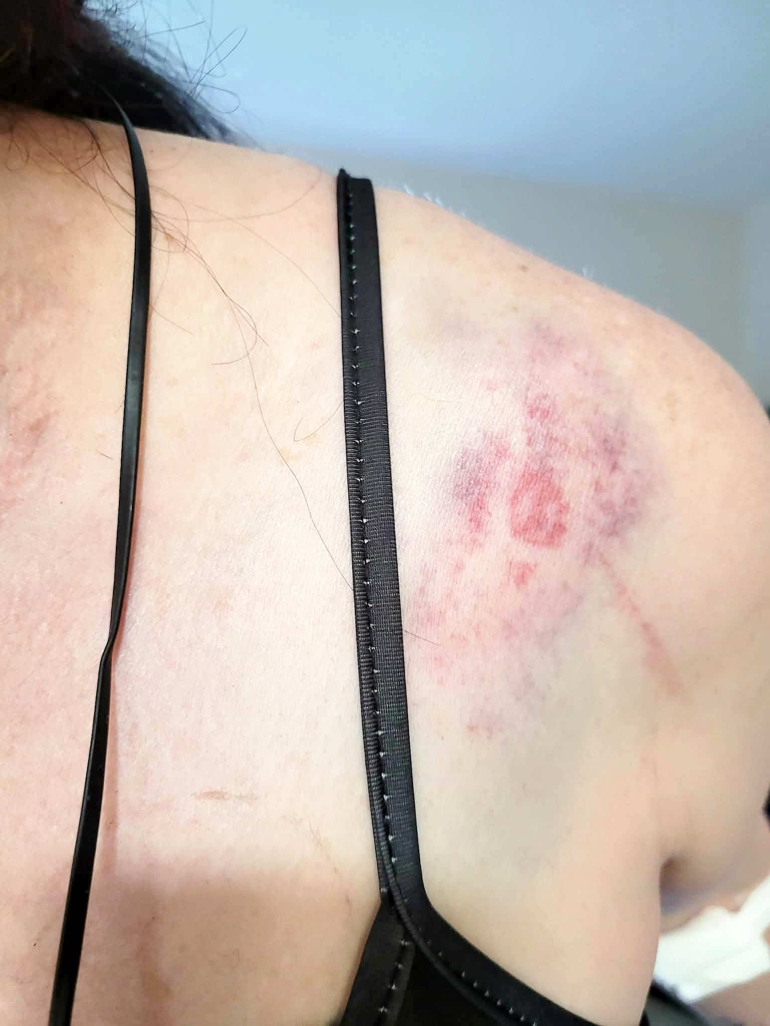 Attaquée par son ex récidiviste, elle craint de mourir s’il s’en ...