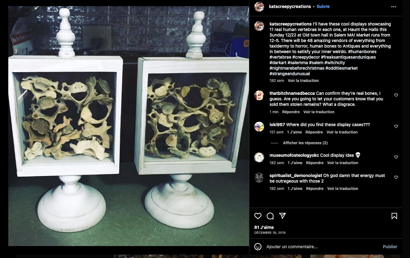 L'ex-directeur de la morgue à Harvard volait des organes | JDM