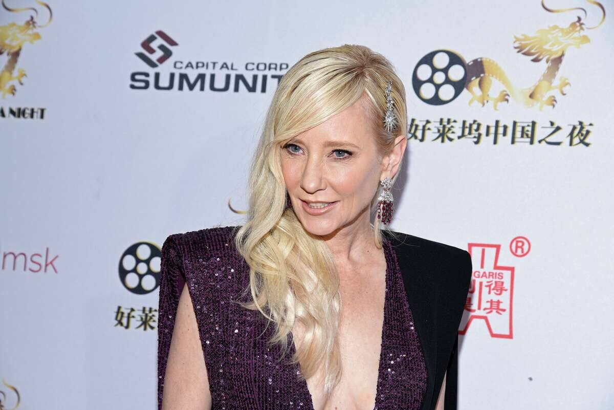 Don d’organes : Anne Heche débranchée dimanche | TVA Nouvelles