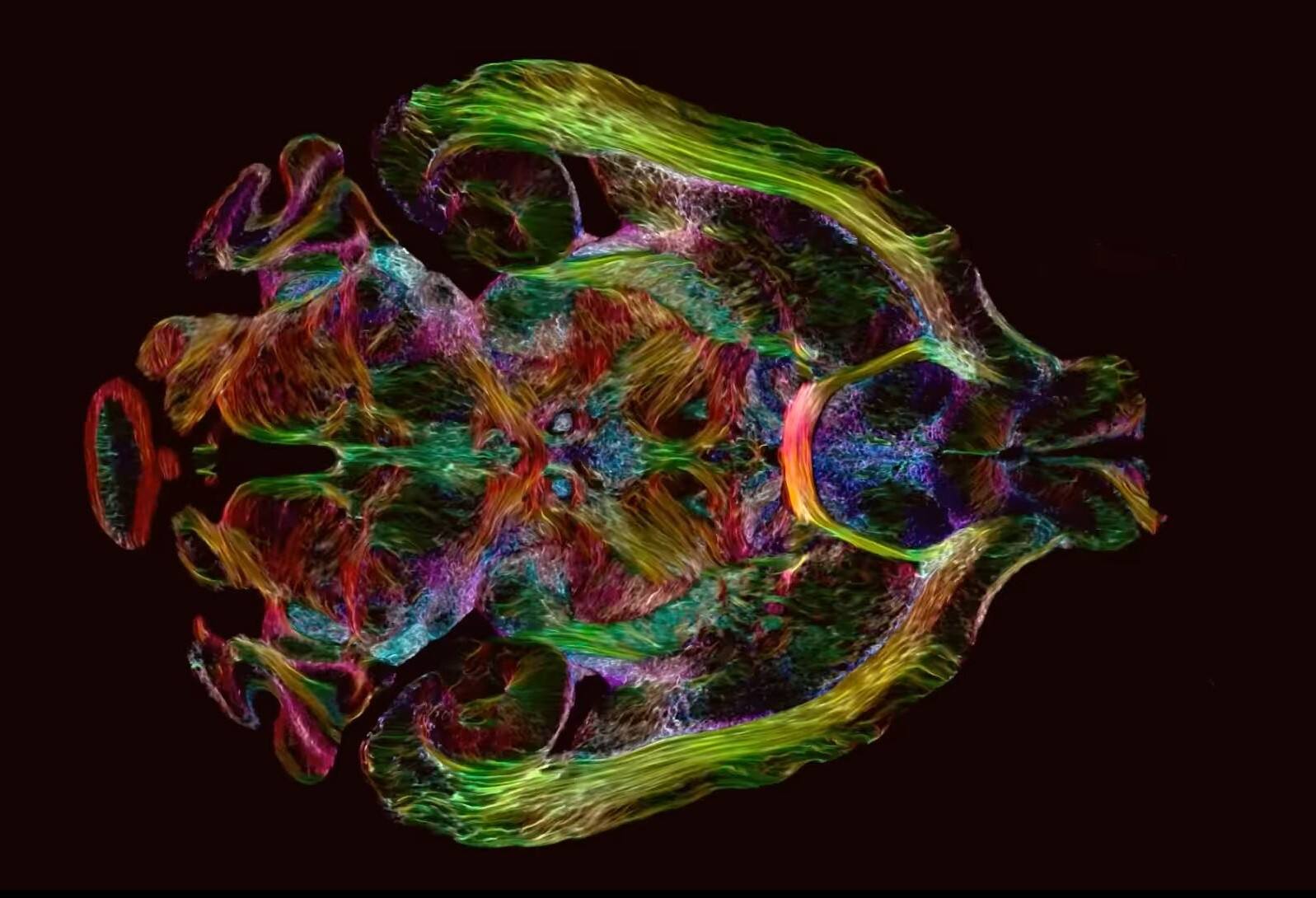 Brain images 64 million times more detailed than a traditional MRI ...