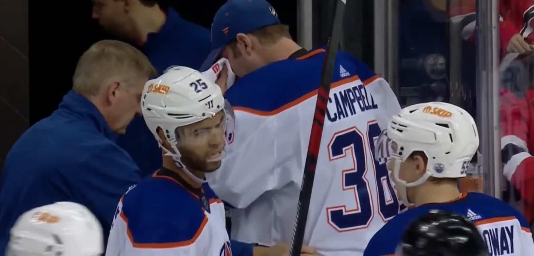 Jack Campbell s'est cassé le nez... au banc! | JDQ