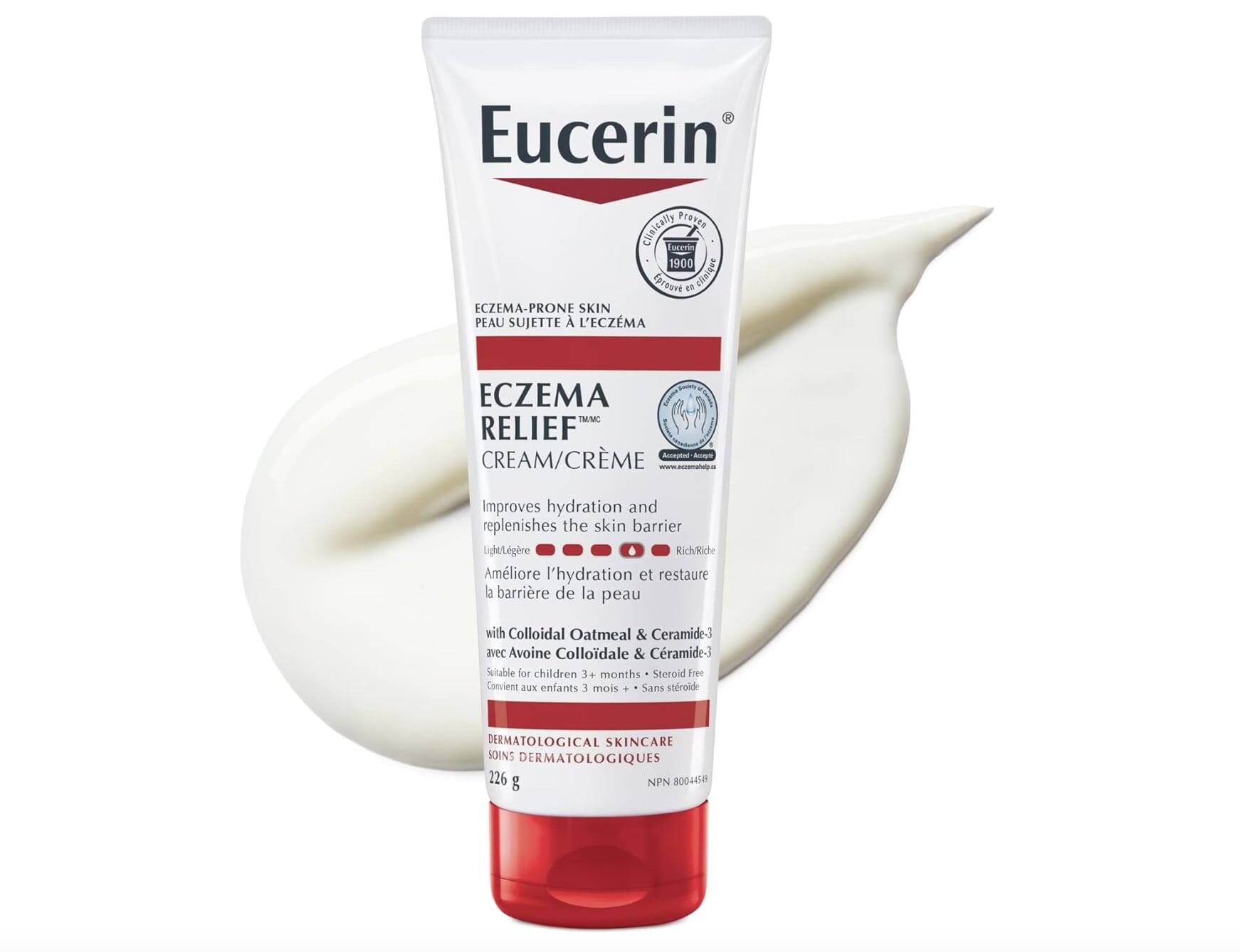 Causes et solutions pour 10 types de plaques rouges sur la peau | Salut ...