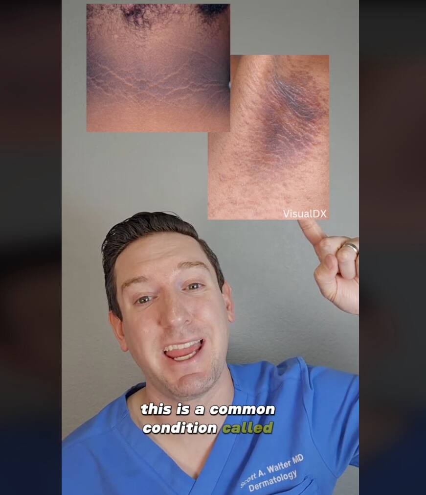 Risques de cancer: vous devriez consulter si vous avez ces taches sur ...