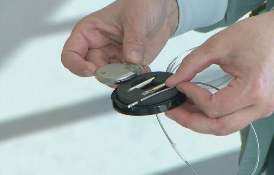 Stimulateur cardiaque: une nouvelle technologie révolutionnaire ...