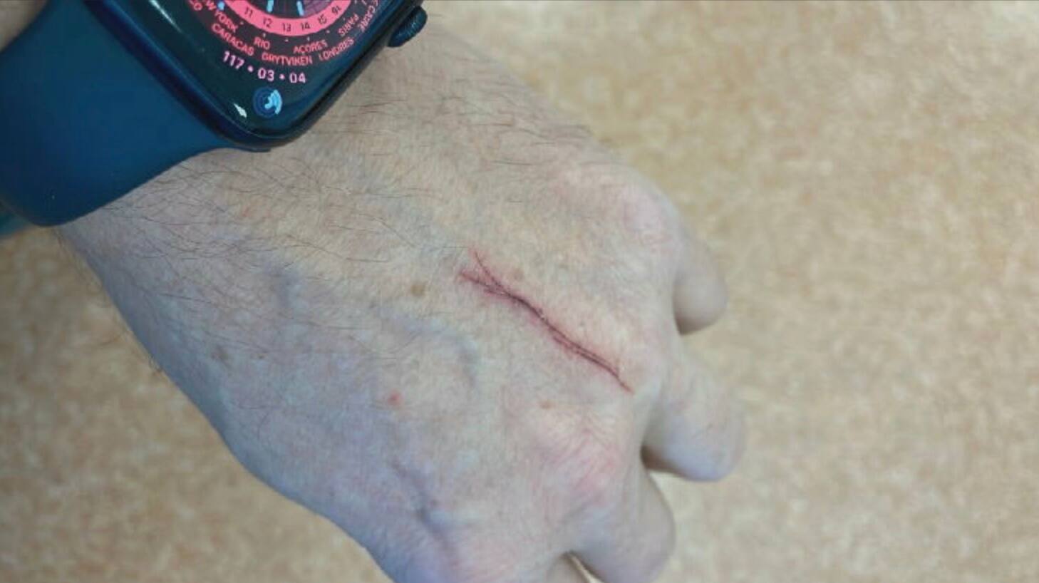 Cauchemar d’un citoyen: piqué par une seringue souillée en voulant ...