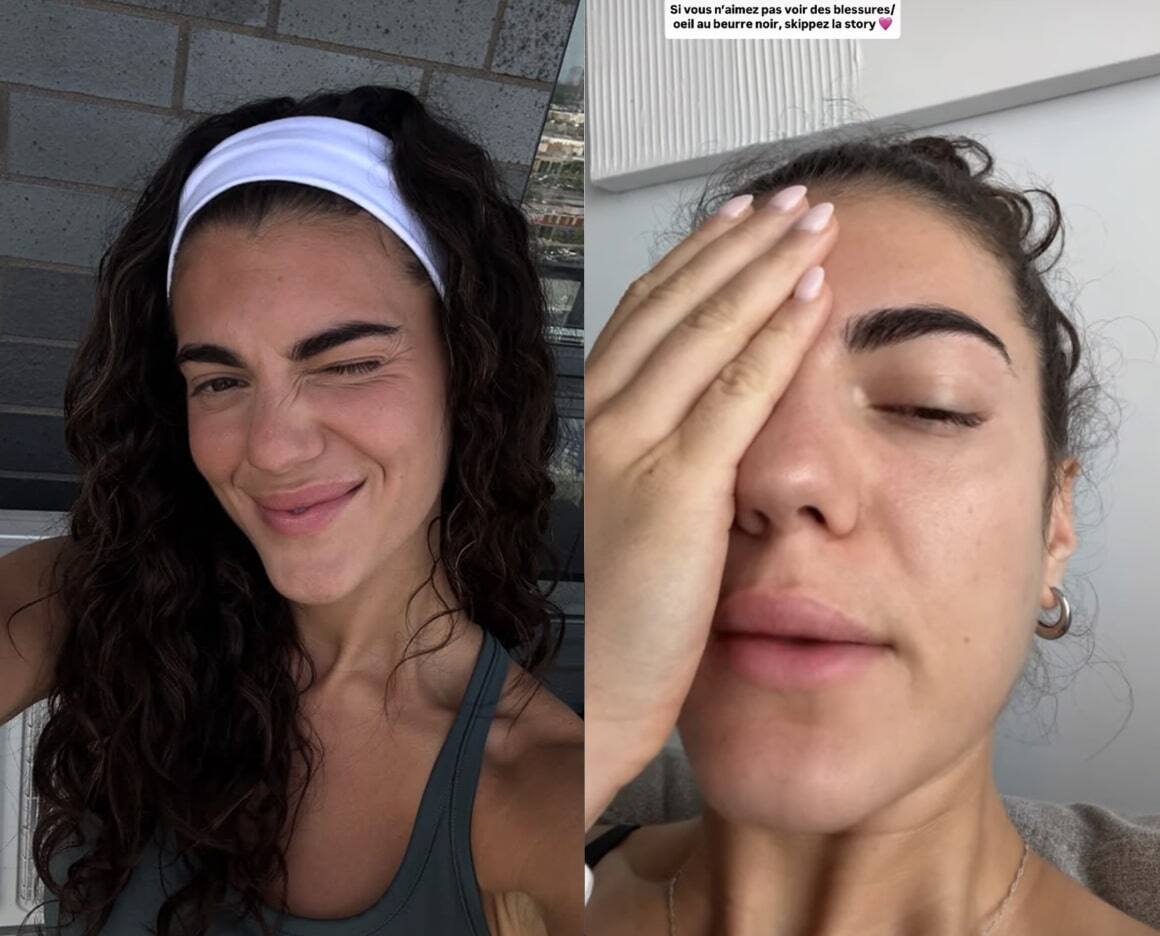 L'ex-participante de téléréalité Megan Cyr se fait lourdement blesser ...