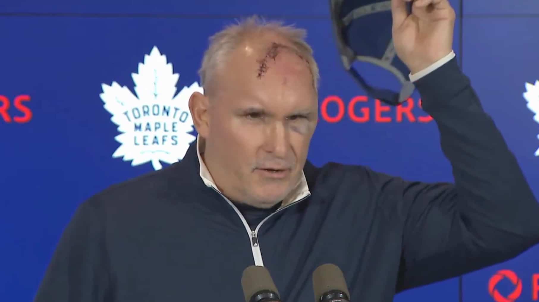 «Accident au gym» : Craig Berube ne s’est vraiment pas manqué... - TVA ...