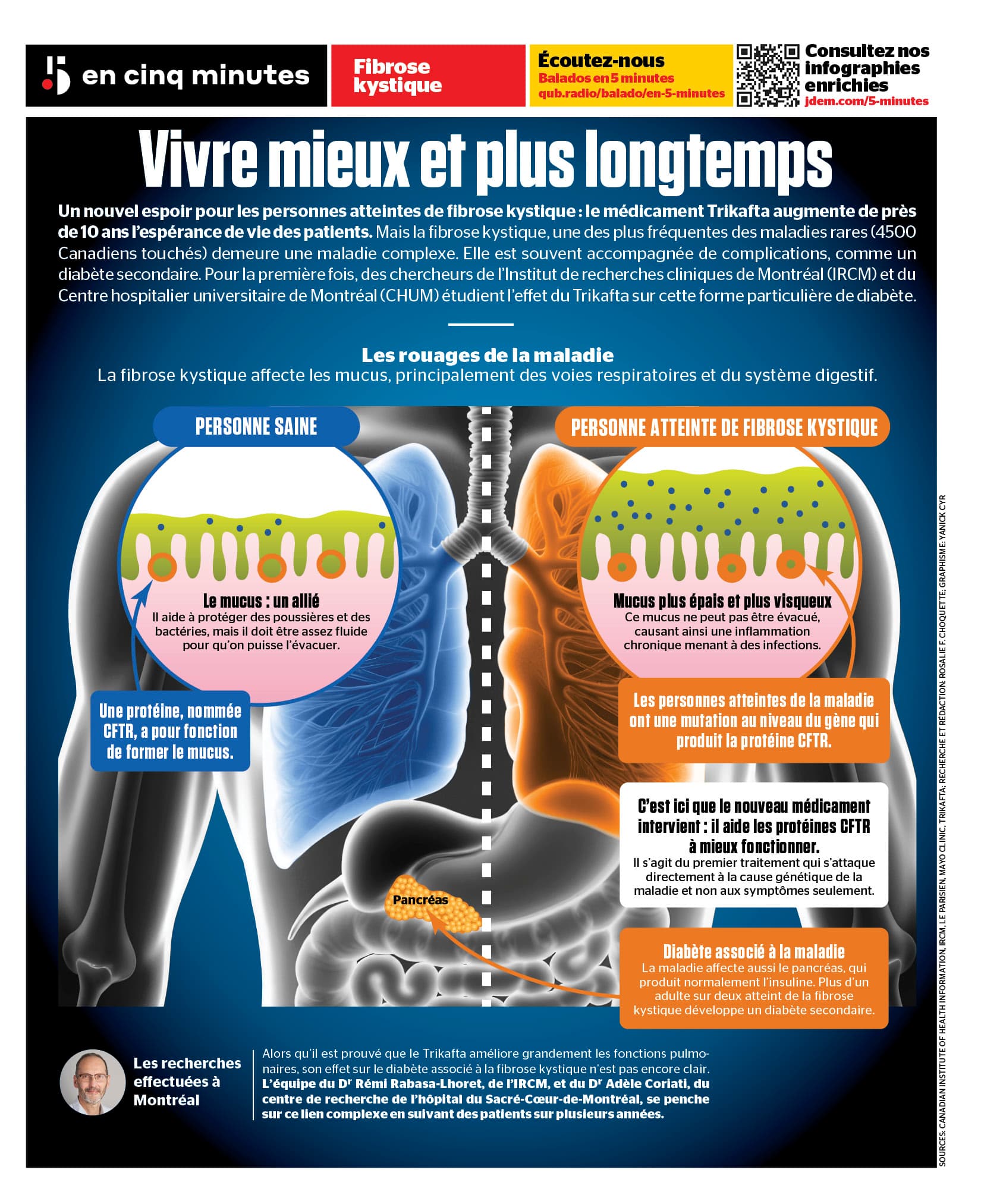 Vivre mieux et plus longtemps avec la fibrose kystique | JDM