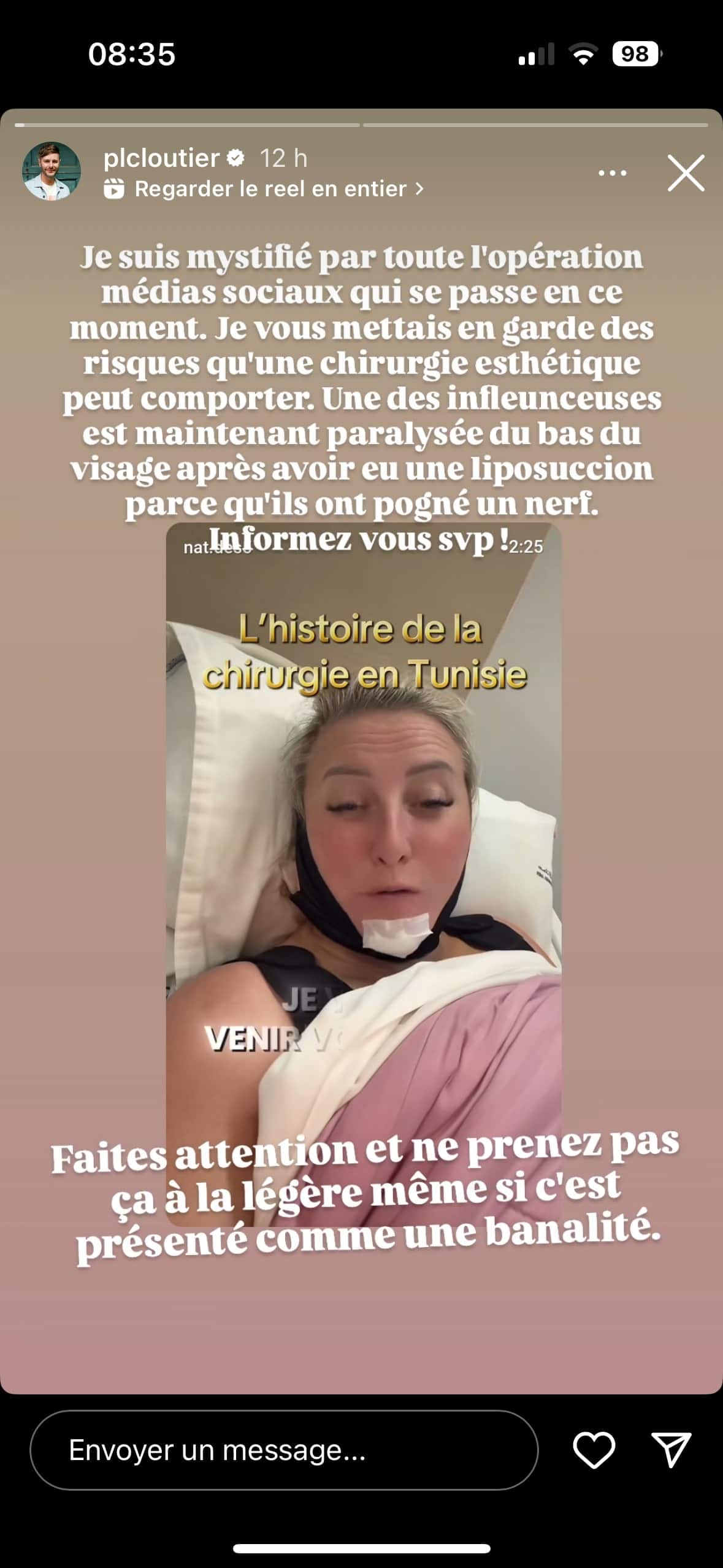 Des influenceuses québécoises connues font la promotion de chirurgies ...