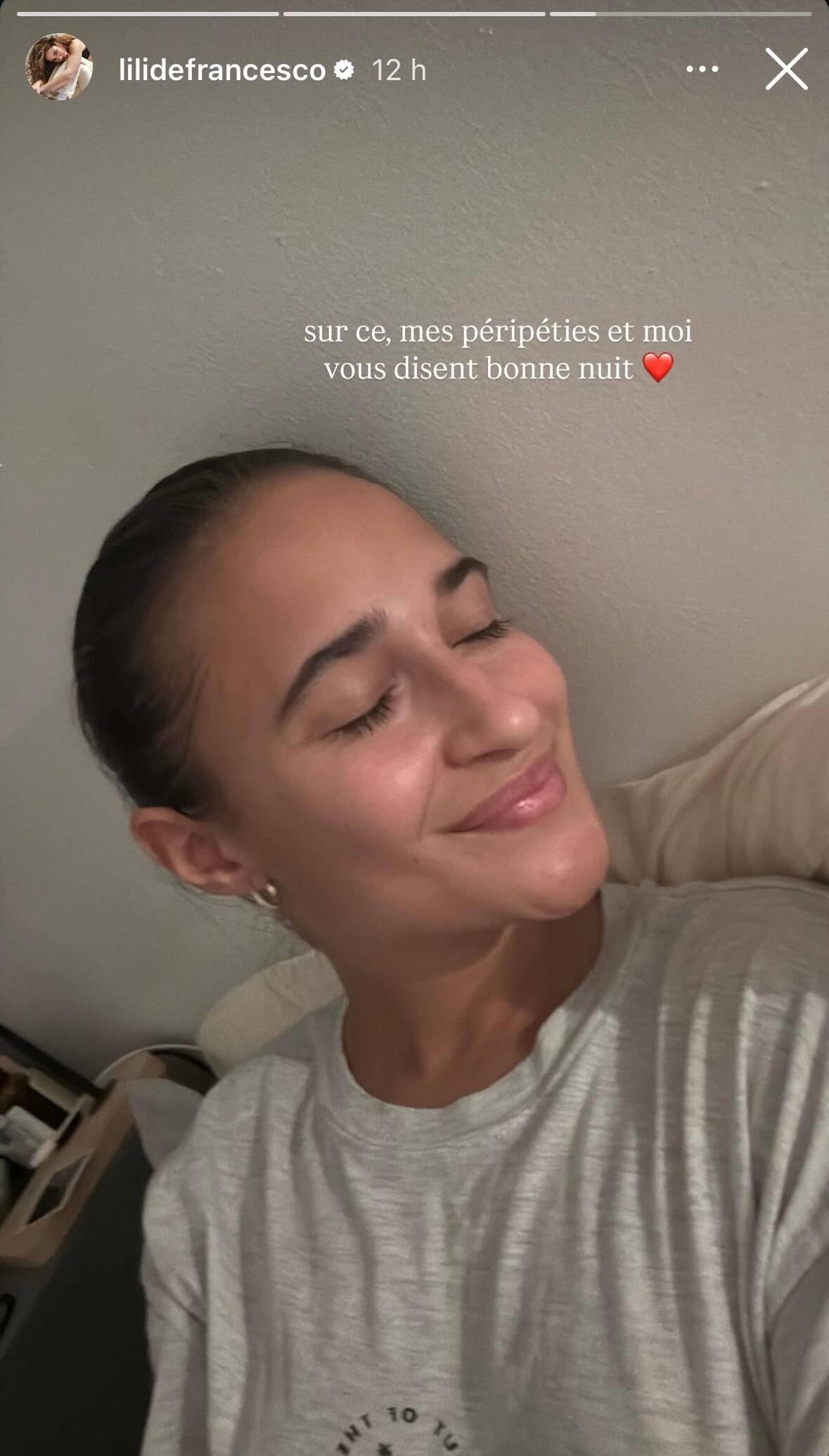 Lili-Ann de Fransesco hospitalisée pour un kyste d'une grosseur ...