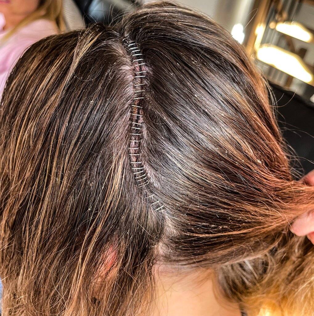 «Ça change tout pour moi»: cette jeune maman atteinte d’un cancer du ...