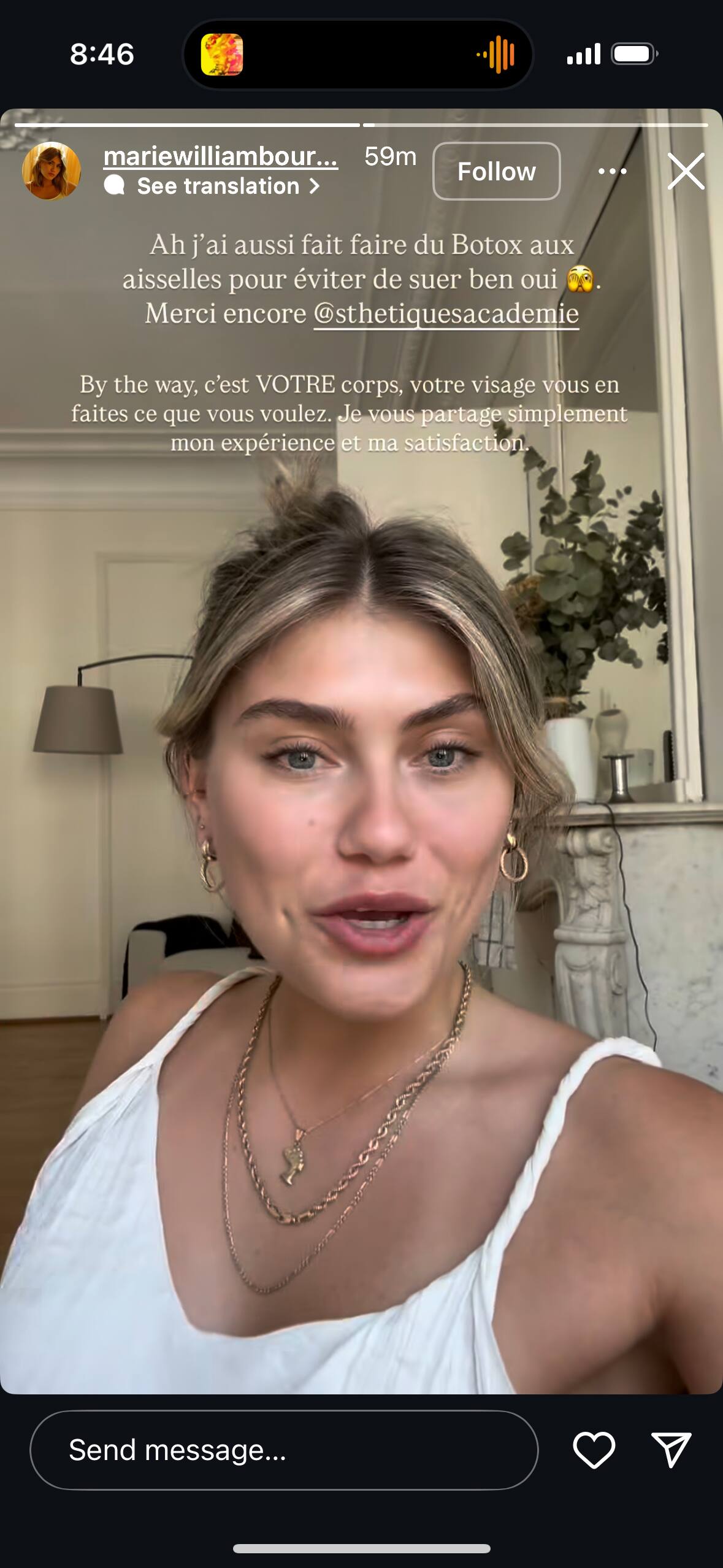 Marie-William Bourgeois se prononce sur son recours au Botox | billie