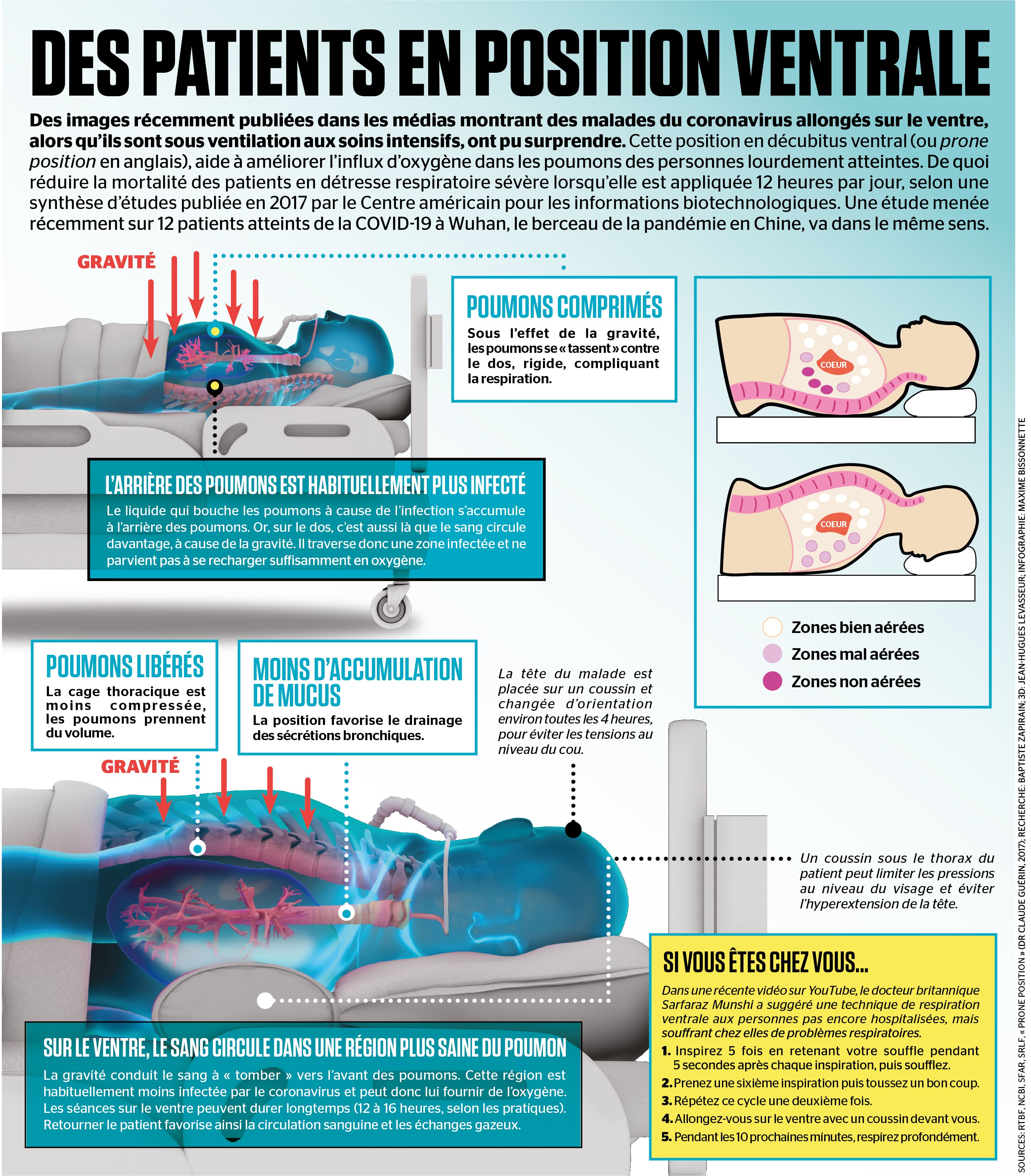 Des patients en position ventrale | Le Journal de Québec