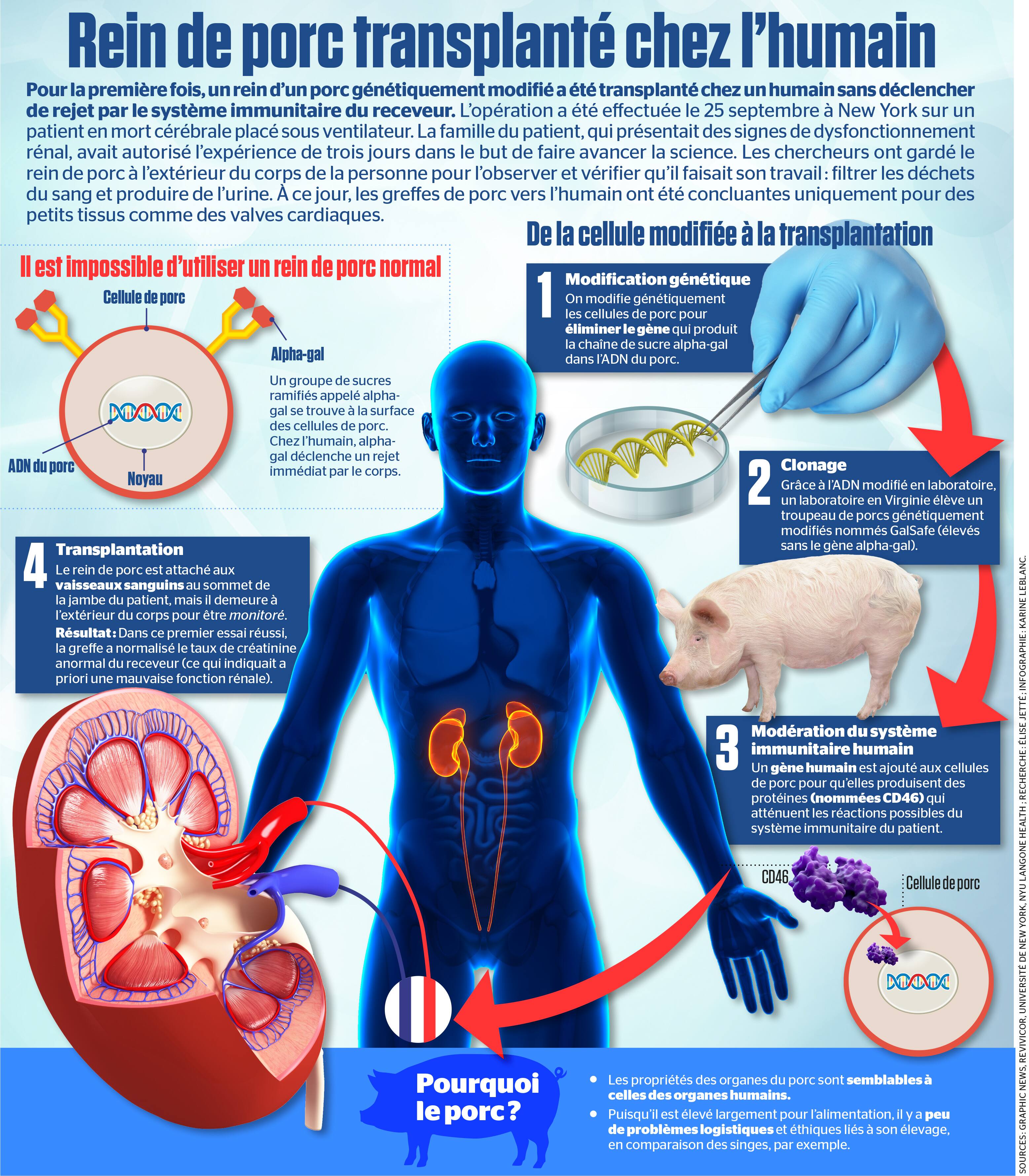 Rein de porc transplanté chez l’humain | JDM