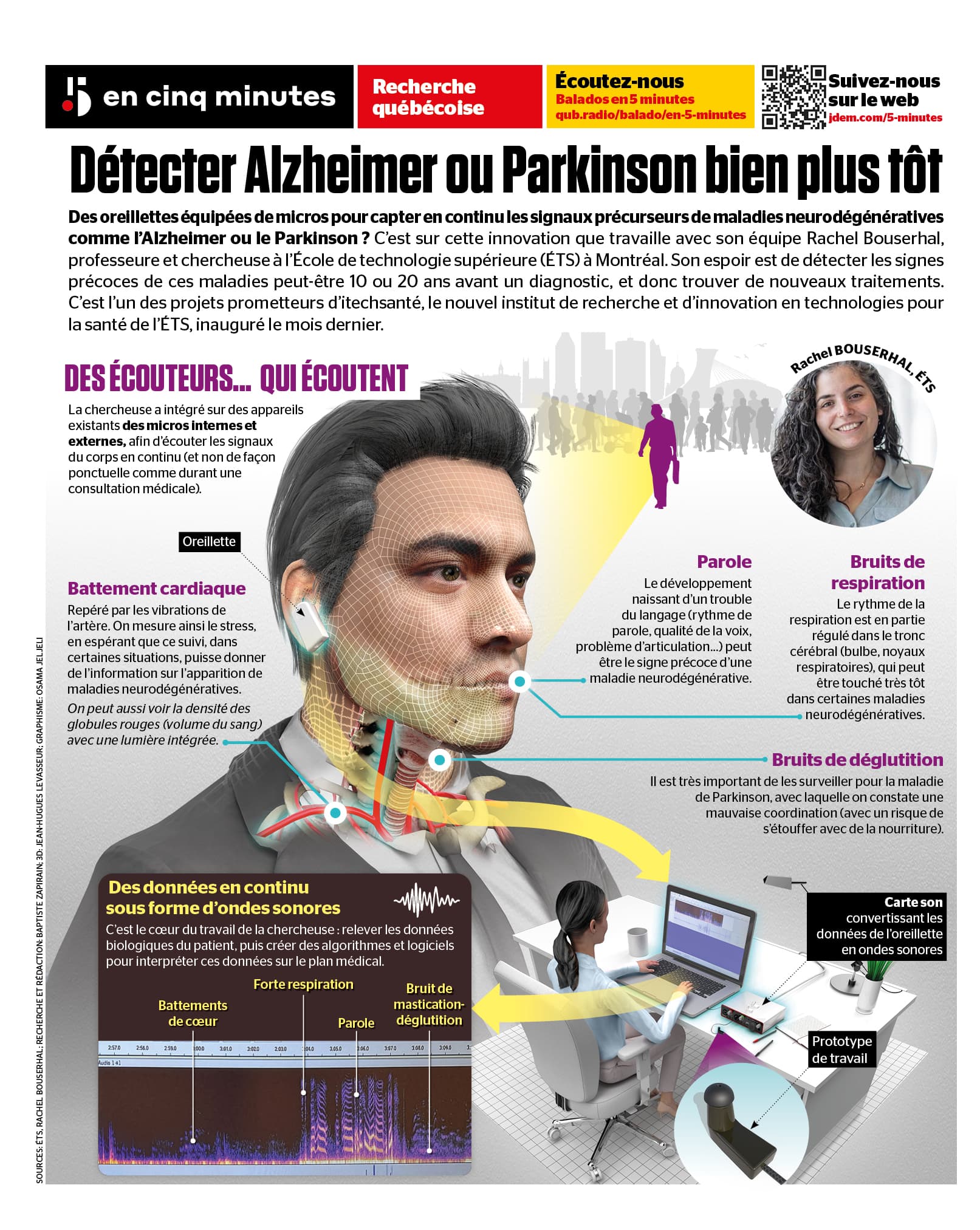 INFOGRAPHIE | Détecter Alzheimer ou Parkinson bien plus tôt... avec une ...