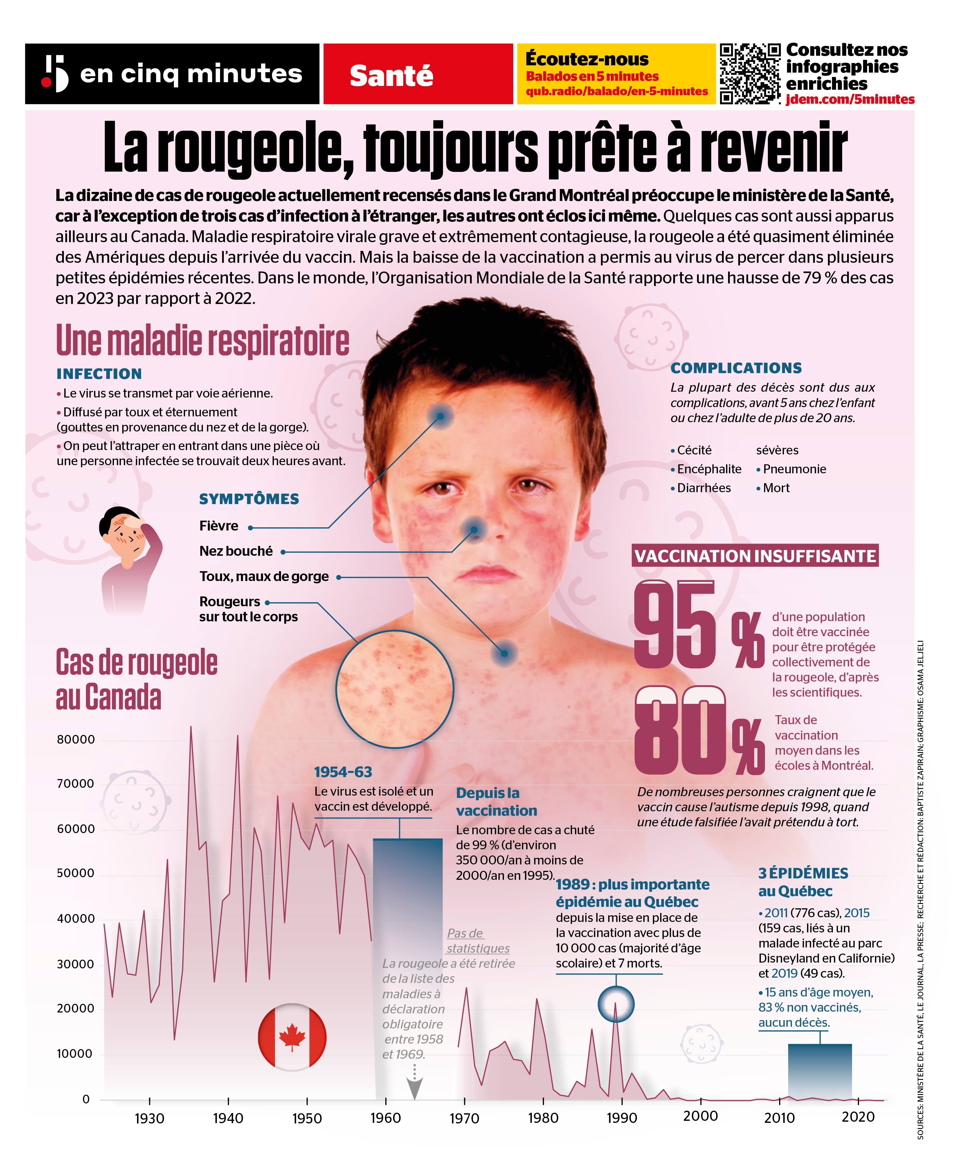 La rougeole, toujours prête à revenir | JDQ
