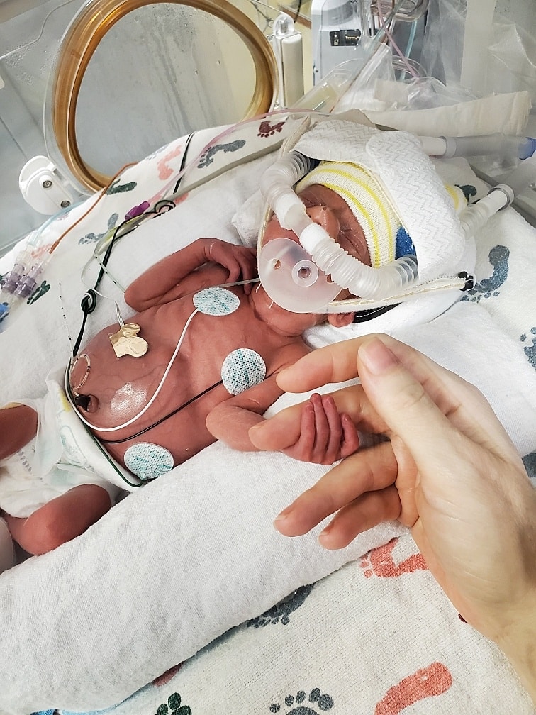 Elisabetta Fantone se confie sur la naissance prématurée de son bébé et ...