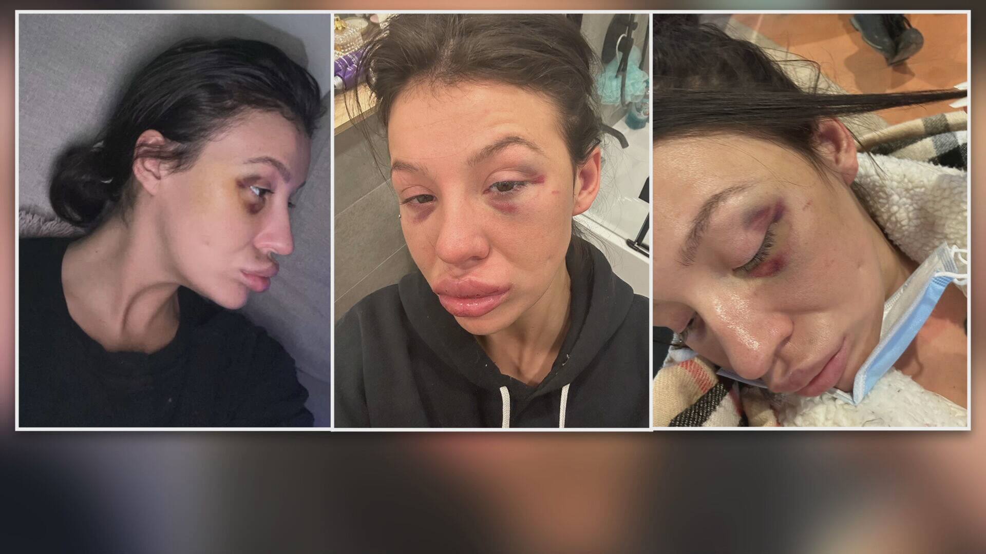 Yan-Philippe Leduc aurait fait une autre victime: «Il m’a étranglée à ...