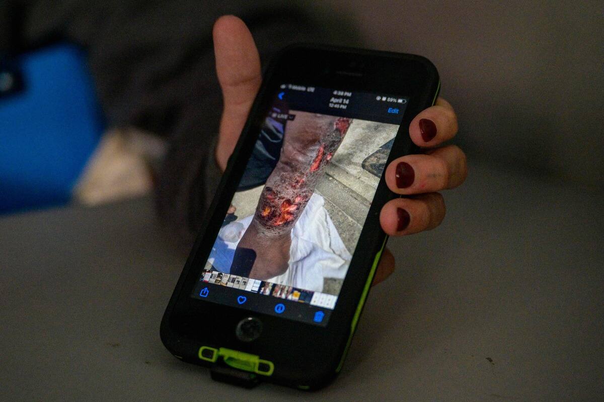 La drogue «tranq», dernière menace sur le marché américain | JDM