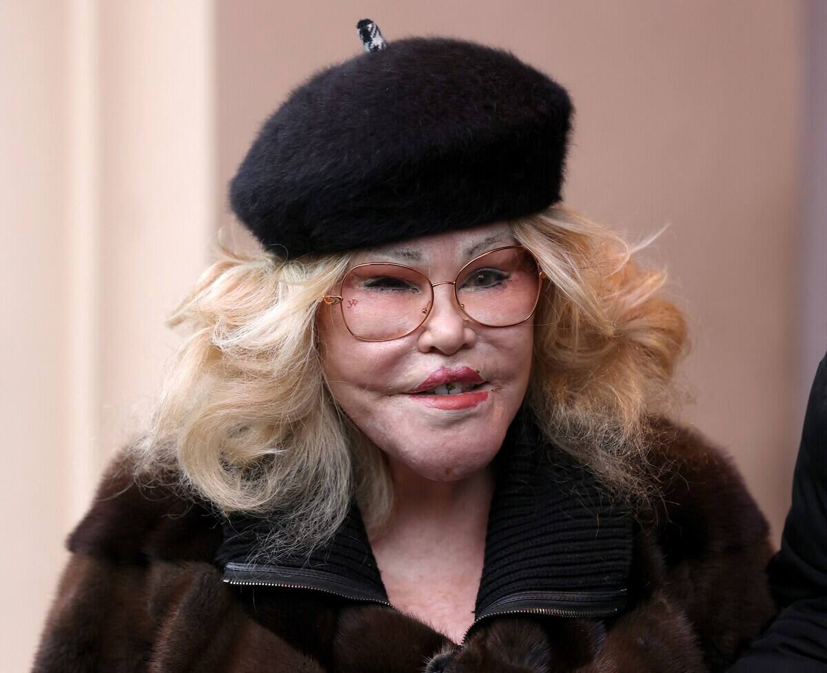 La «femme chat», Jocelyne Wildenstein, décède à 79 ans | TVA Nouvelles