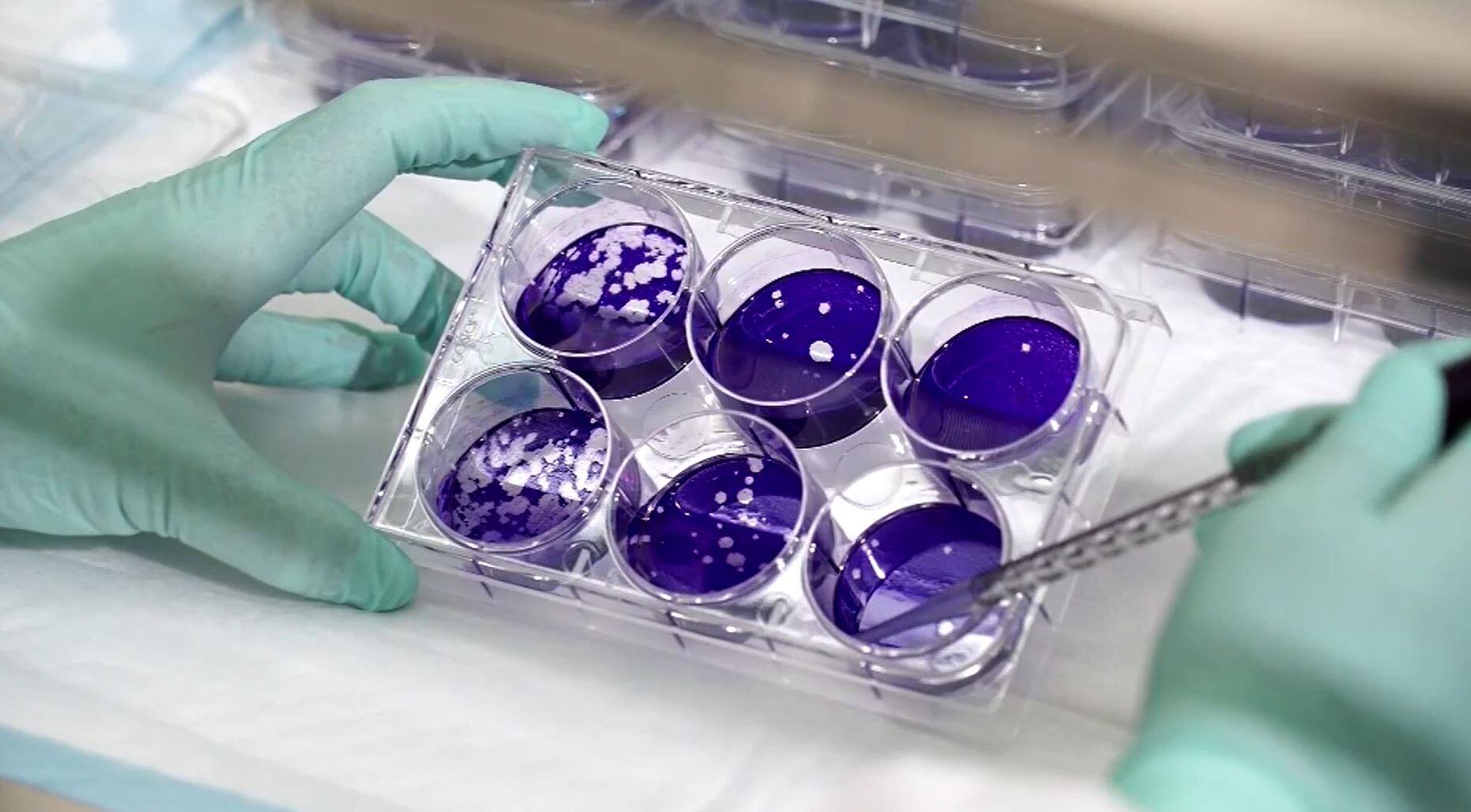 "Understanding Long COVID: Researchers Identify Three Main Causes at ...