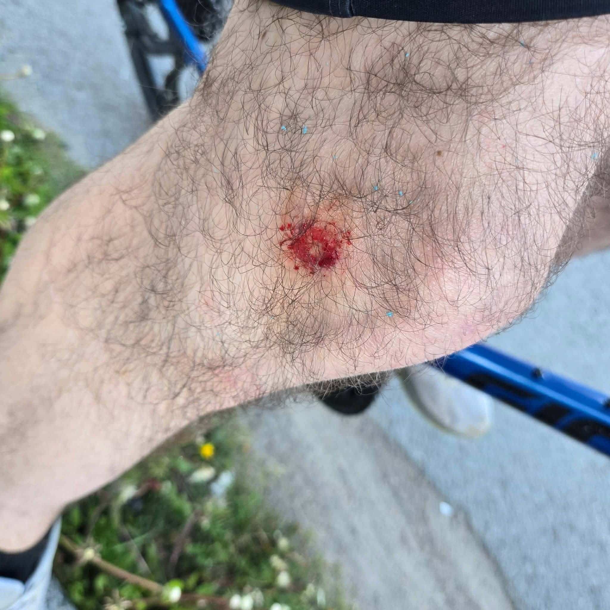 Promenade Samuel-De Champlain: un cycliste visé avec un fusil de ...