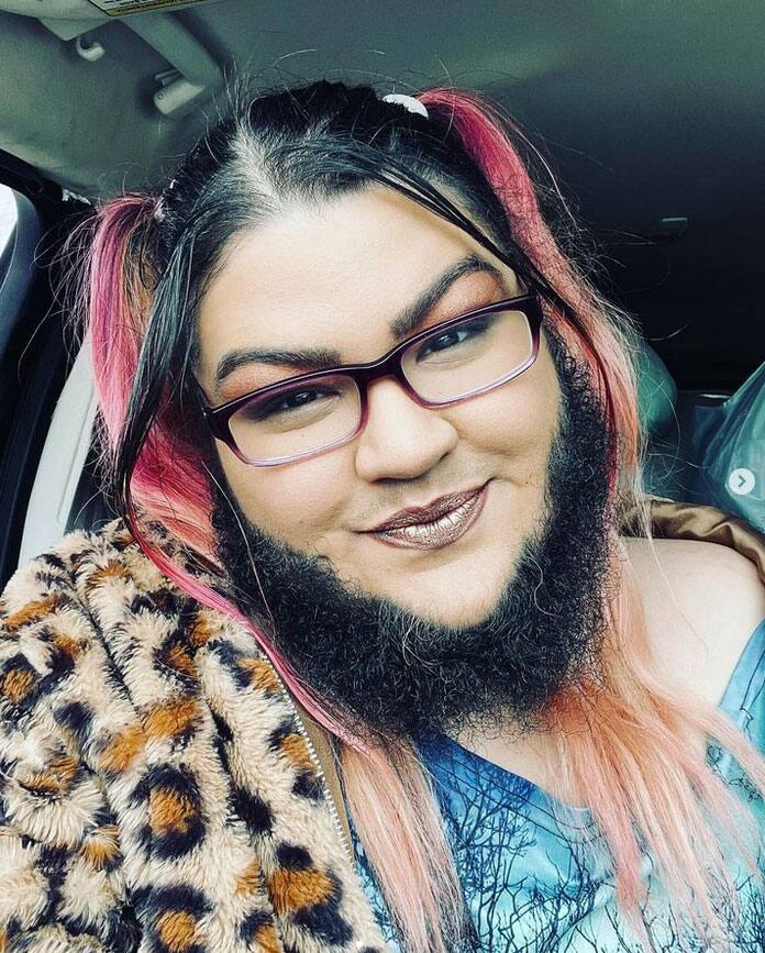 «Je suis belle»: elle porte fièrement sa barbe fournie | JDM