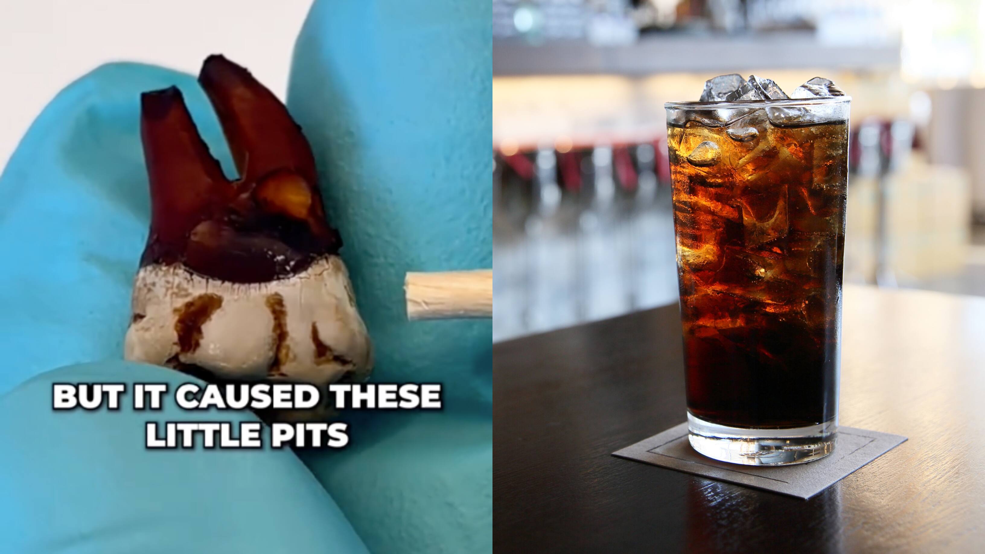 Coca-Cola, café, vin rouge: un dentiste révèle quelle boisson tache le ...