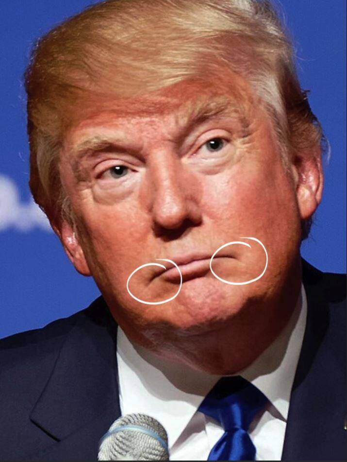 Deux médecins esthétiques analysent l’usure des visages de Trump et de ...